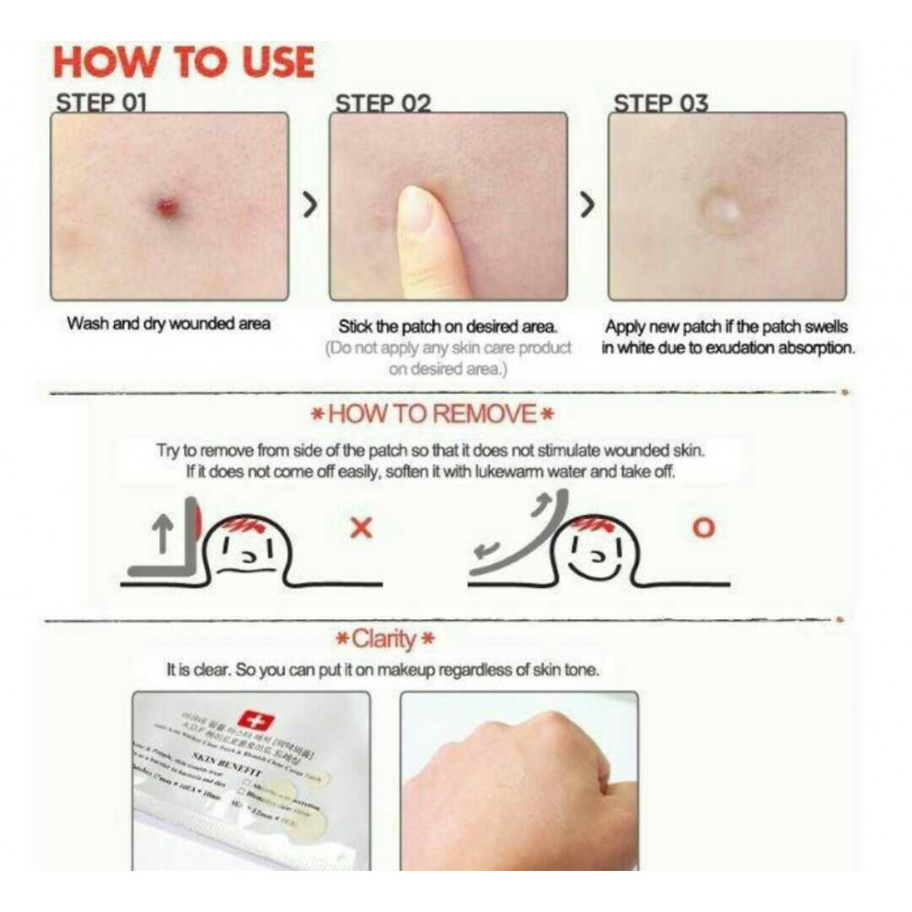 COSRX ACNE PIMPLE MASTER